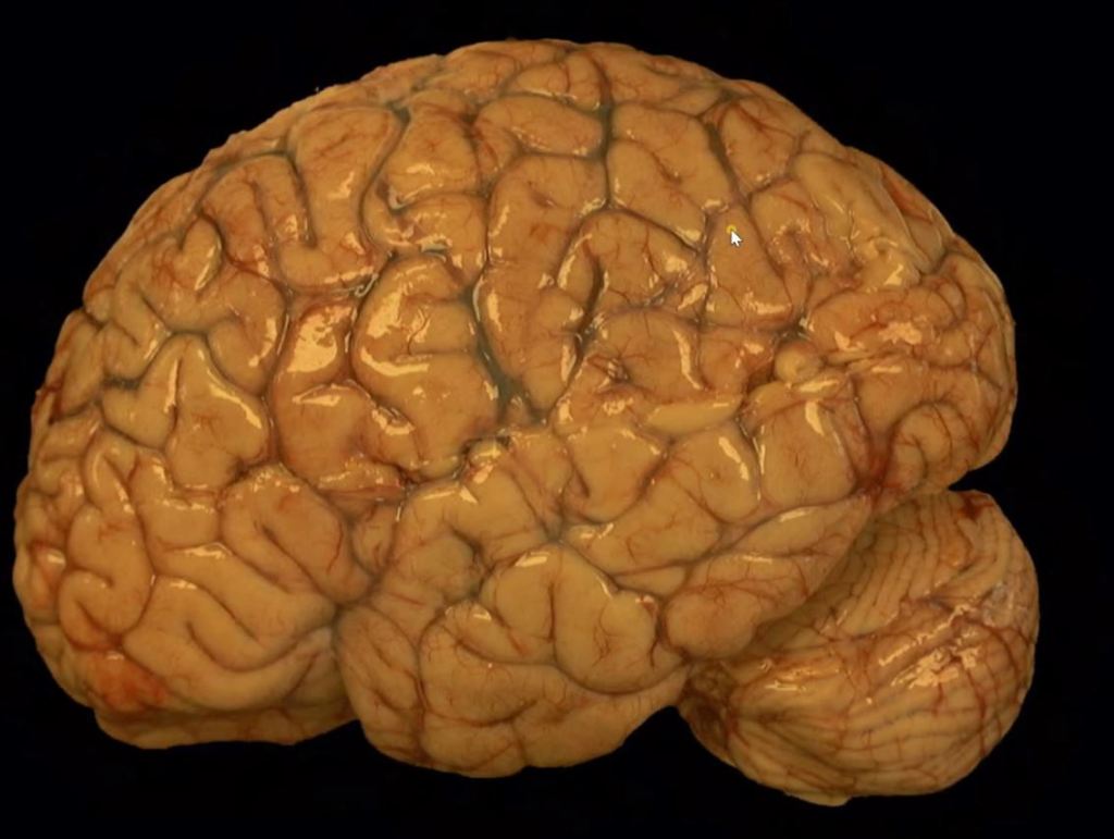 Neuroanatomy Videos – Adventures in Neuropathology