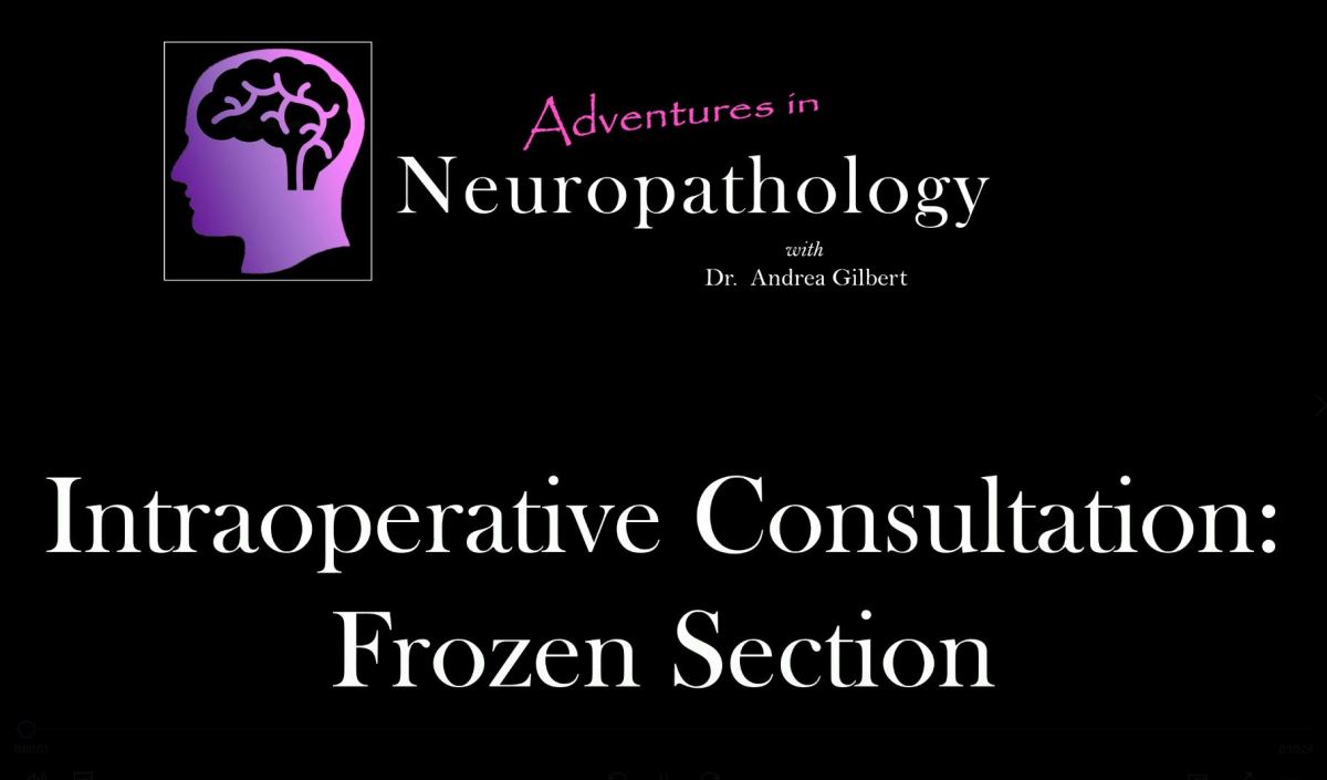 Video: Intraoperative Consultation – Frozen Section – Adventures in ...